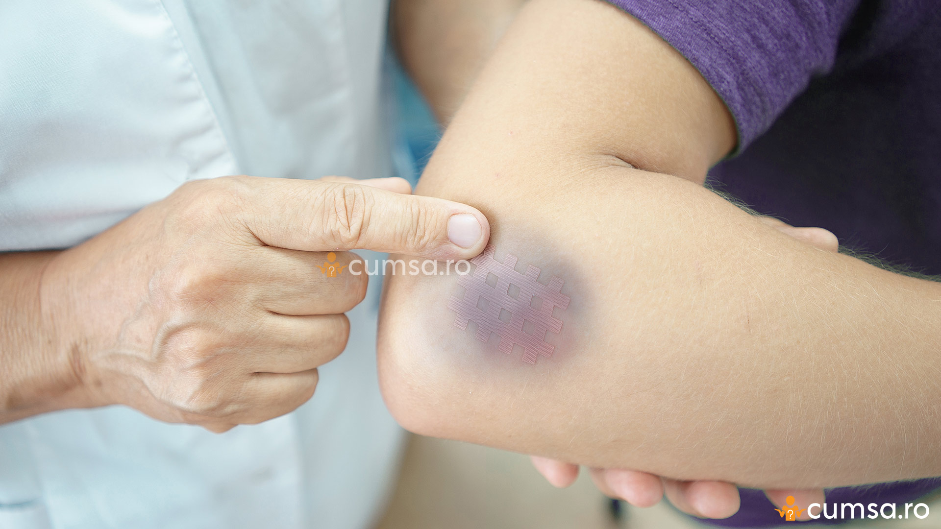 Cum sa scapi de vanatai. Remedii naturale - cumsa.ro